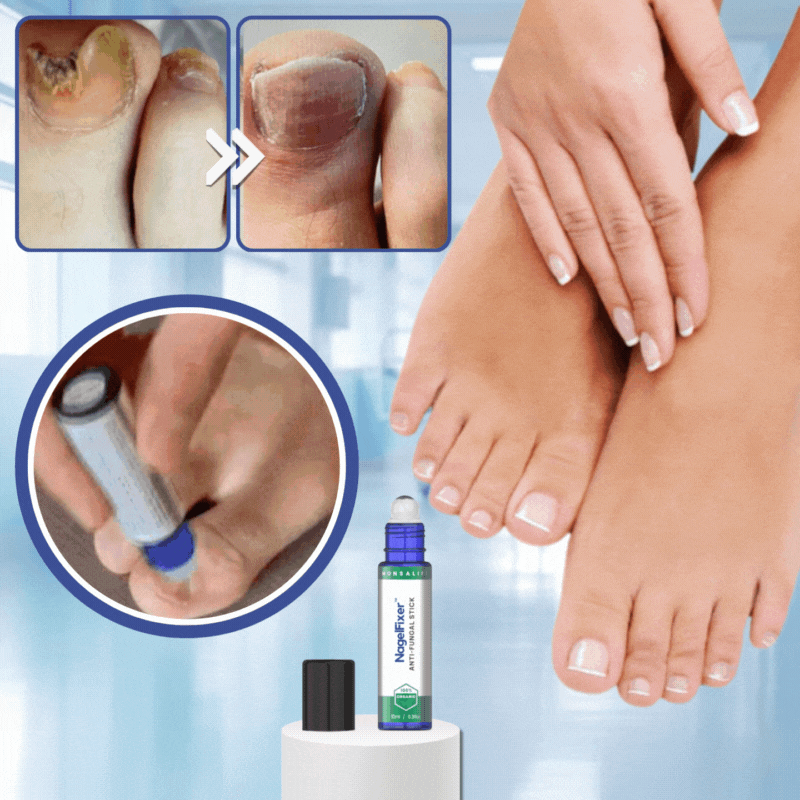 NagelFixer™ | Nagelpflege Roll-on – Karl & Lina